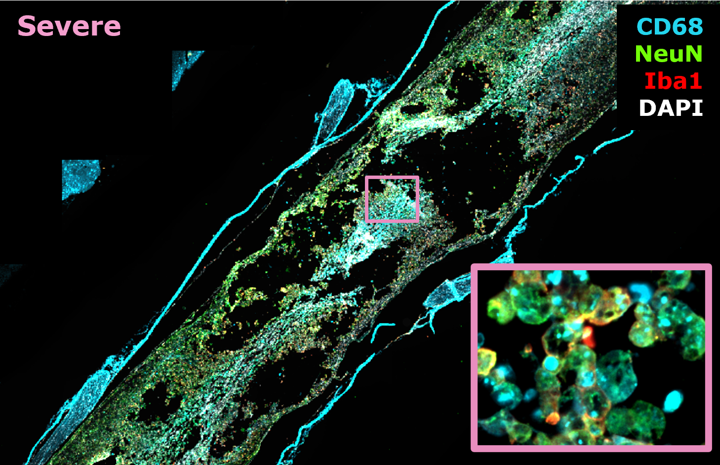 Spinal Cord Injury (SCI) Research | PsychoGenics